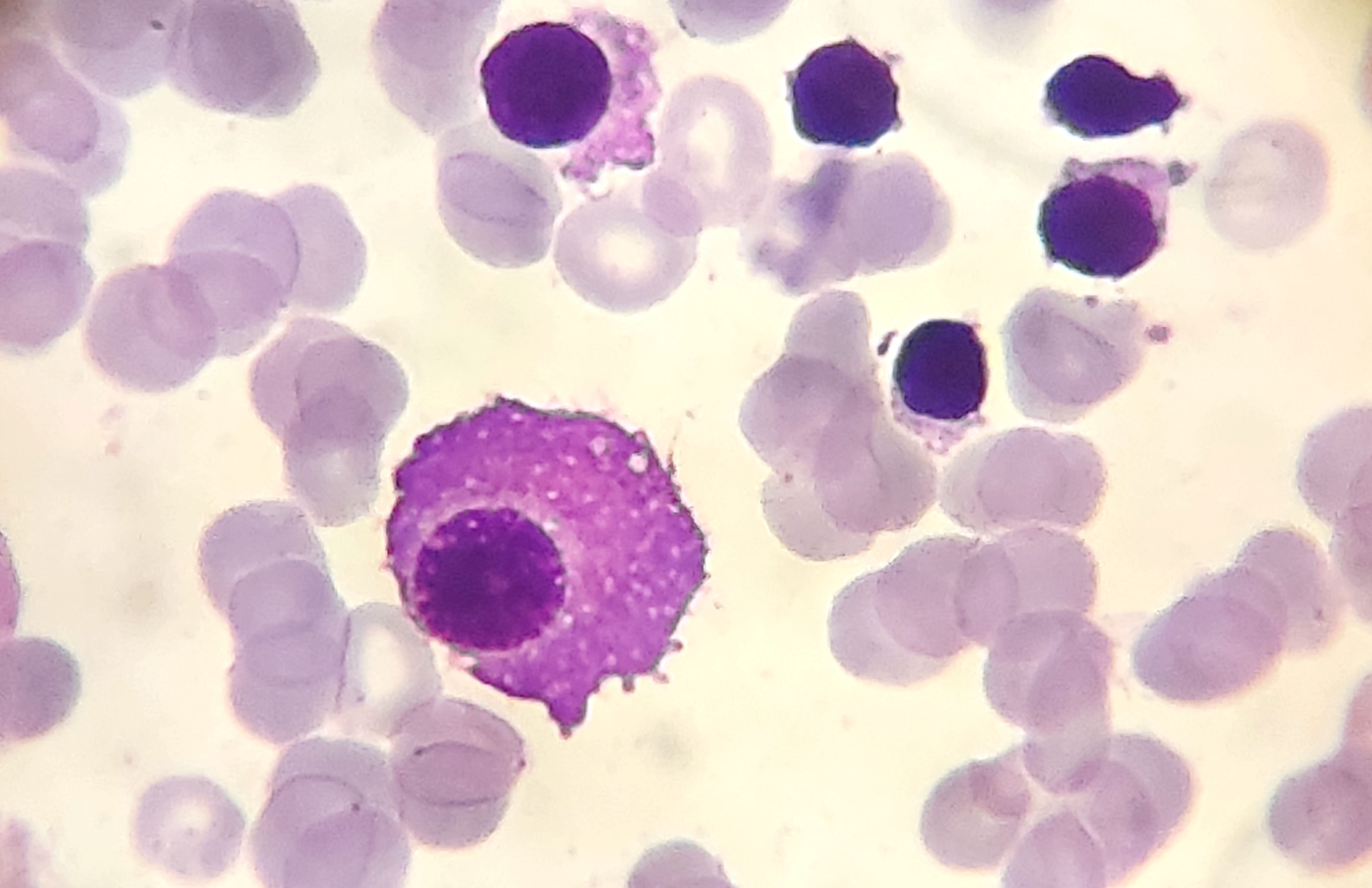 Sociedad Argentina de Hematología