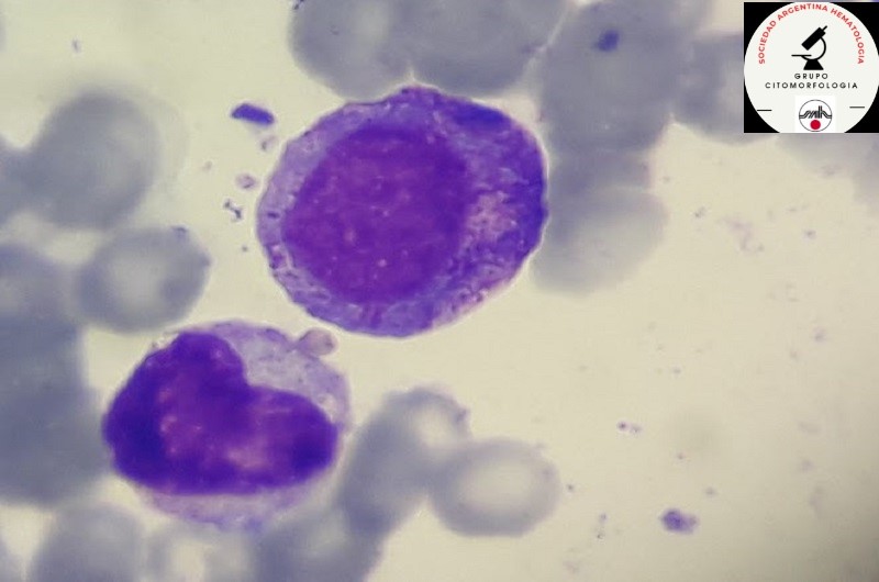 Sociedad Argentina de Hematología