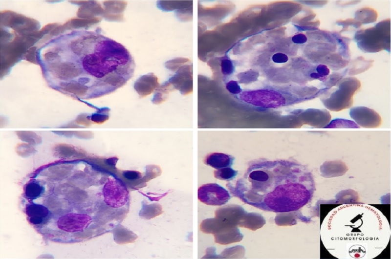 Sociedad Argentina de Hematología